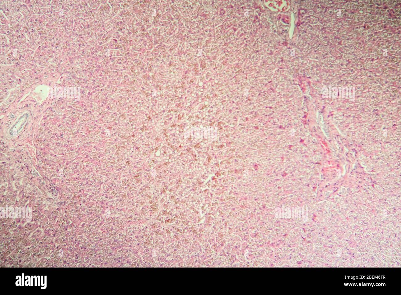 Billirubin in the liver disease in a microscope 100x Stock Photo - Alamy