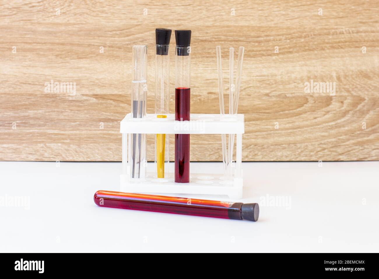 Blood in test tubes. Laboratory for taking blood tests. Virus test ...