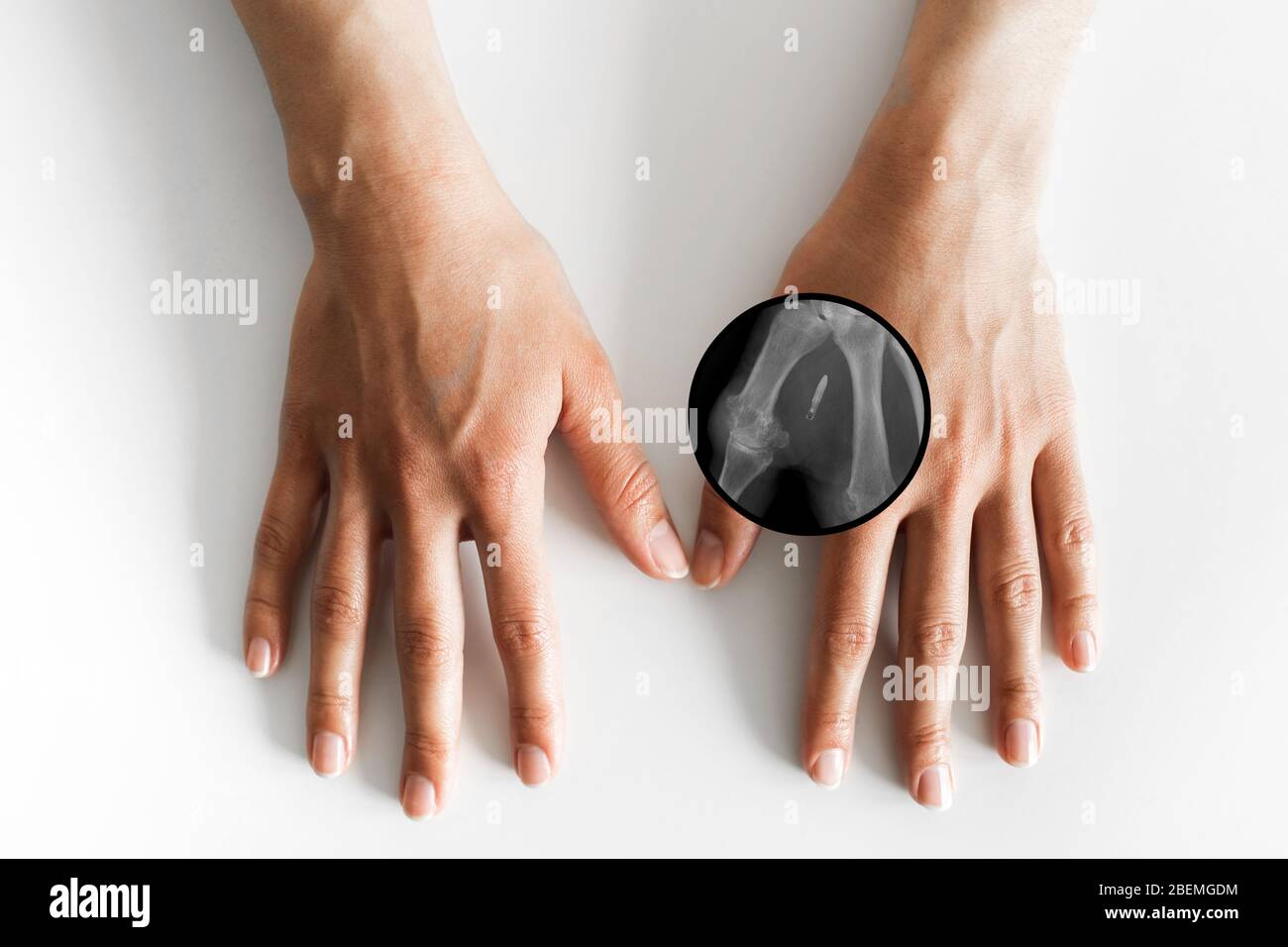 Microchip implant x ray hand hi-res stock photography and images - Alamy