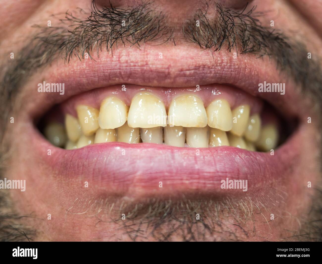 Close-up photo with focus in the middle of the male part of the face ...