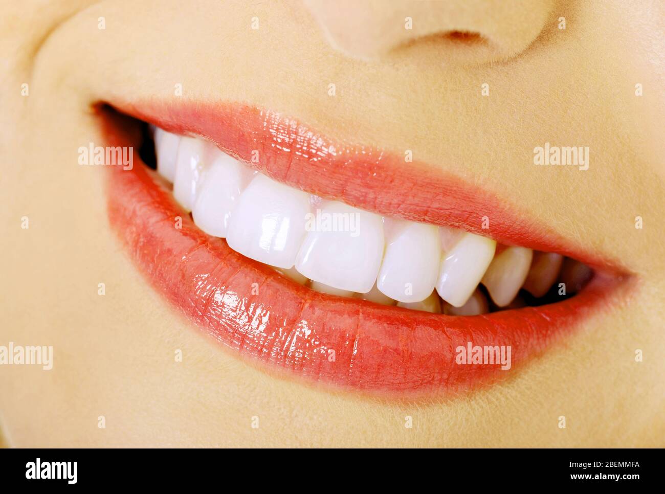 Dental standard hi-res stock photography and images - Alamy