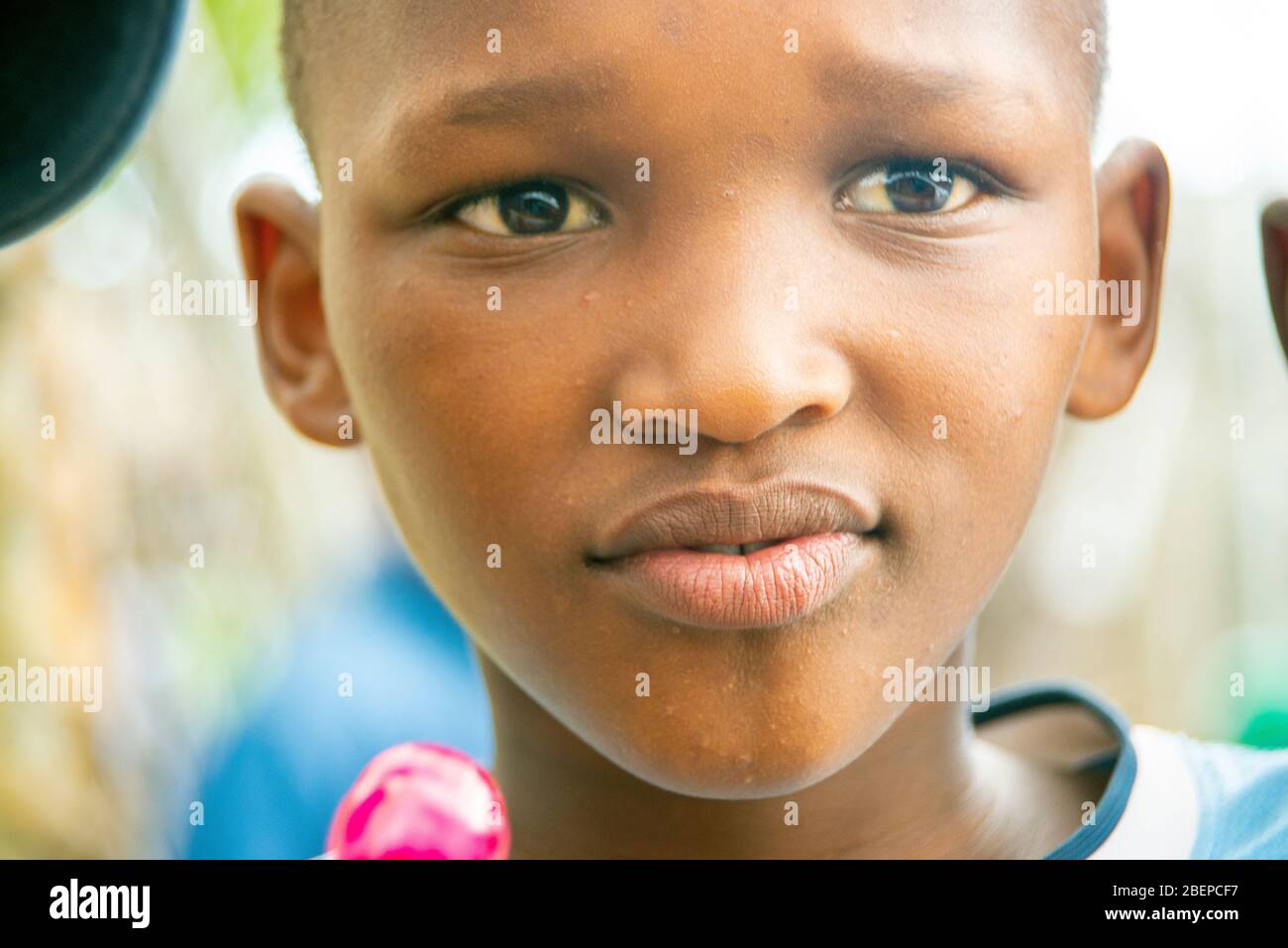 The compelling face of a township boy with pronounced lips and chin ...