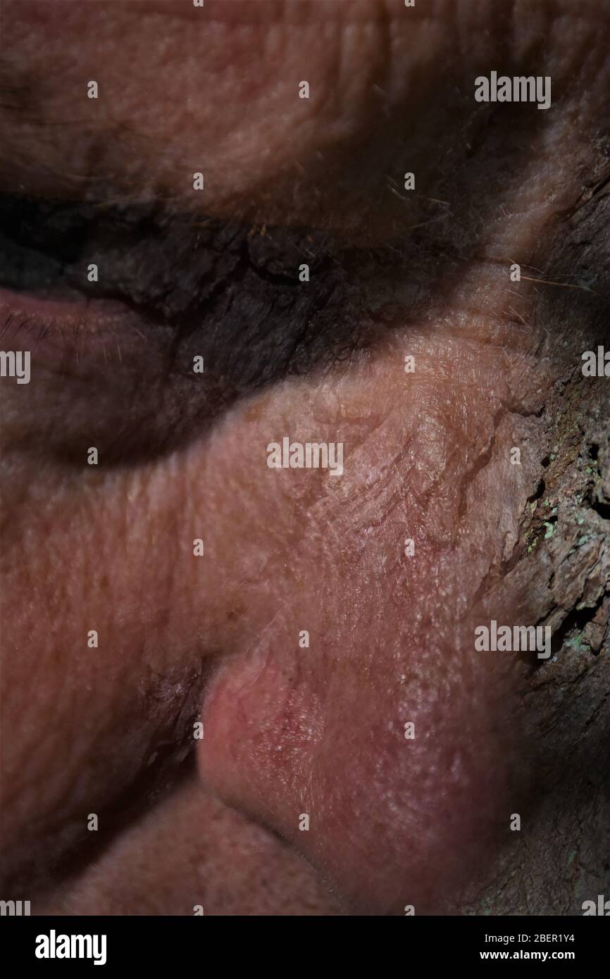 Double exposure of a male face combined with the bark of an oak tree ...