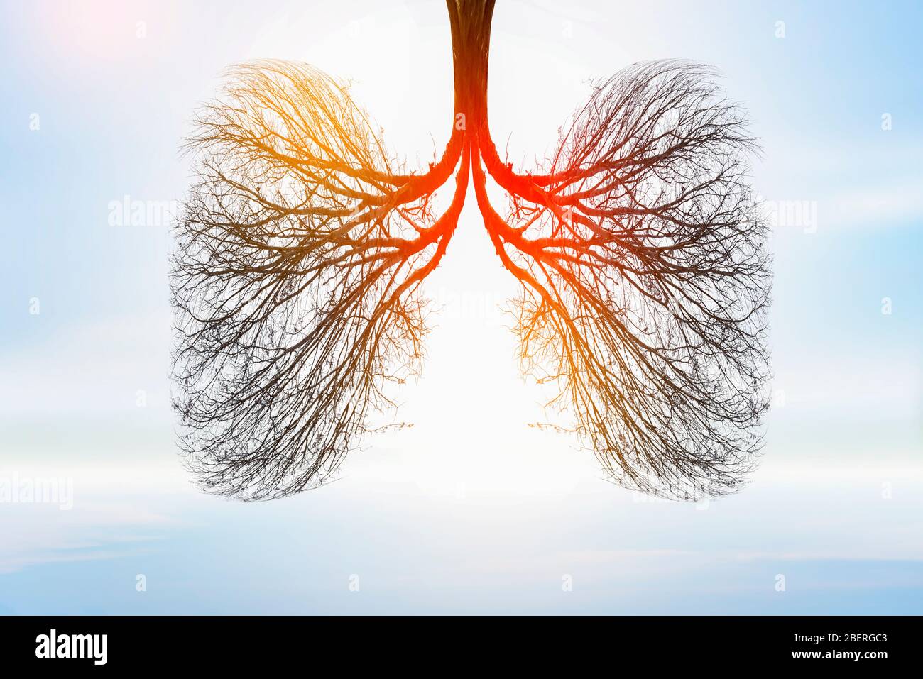 Healthy Lungs X Ray Stock Photos & Healthy Lungs X Ray Stock Images - Alamy