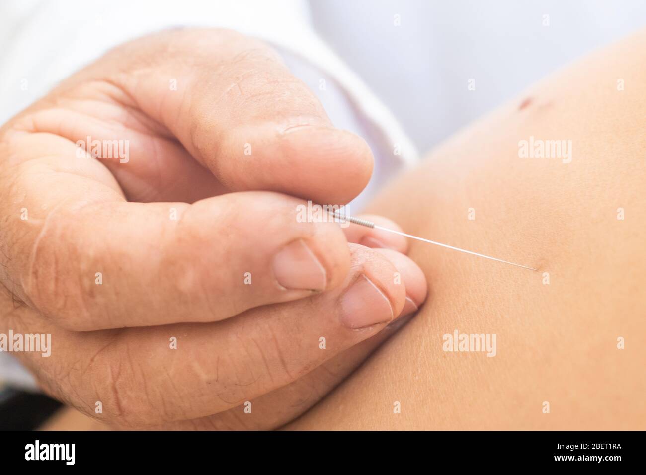 Acupuncture legs hi-res stock photography and images - Alamy