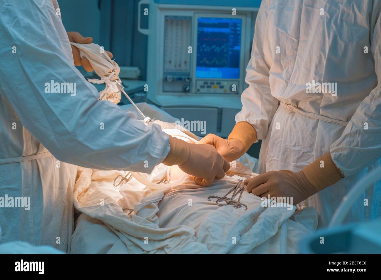 close-up hands of pediatric surgeons perform surgery using laparoscopic ...