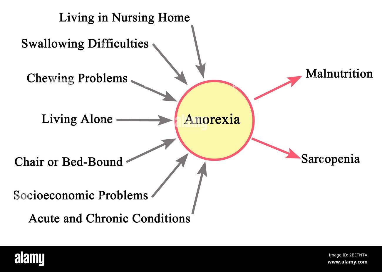 Anorexia: its causes and consequences Stock Photo - Alamy