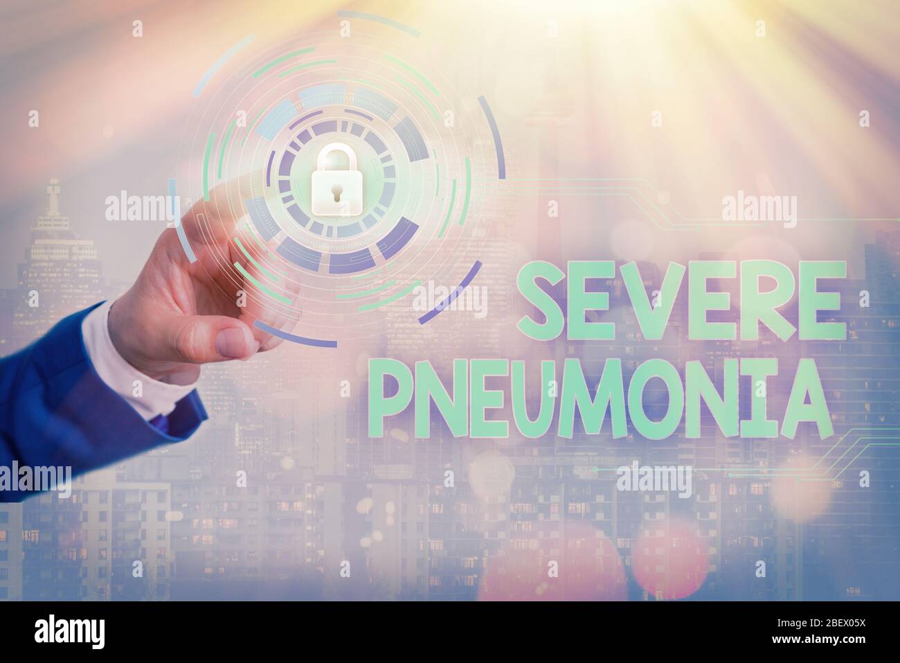 Writing note showing Severe Pneumonia. Business concept for acute ...
