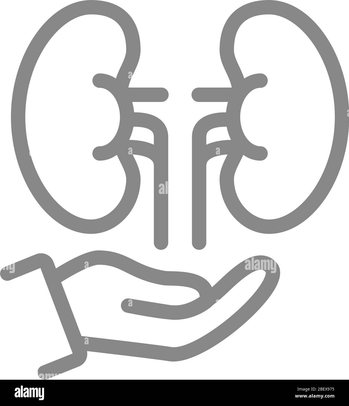 Hand Shake Sign Horseshoe Kidney at Tristan Oflaherty blog