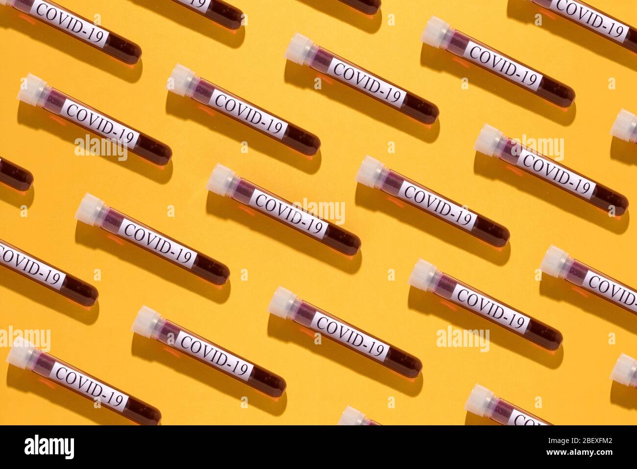 Medical background of aligned coronavirus test tubes labelled Covid-19 ...