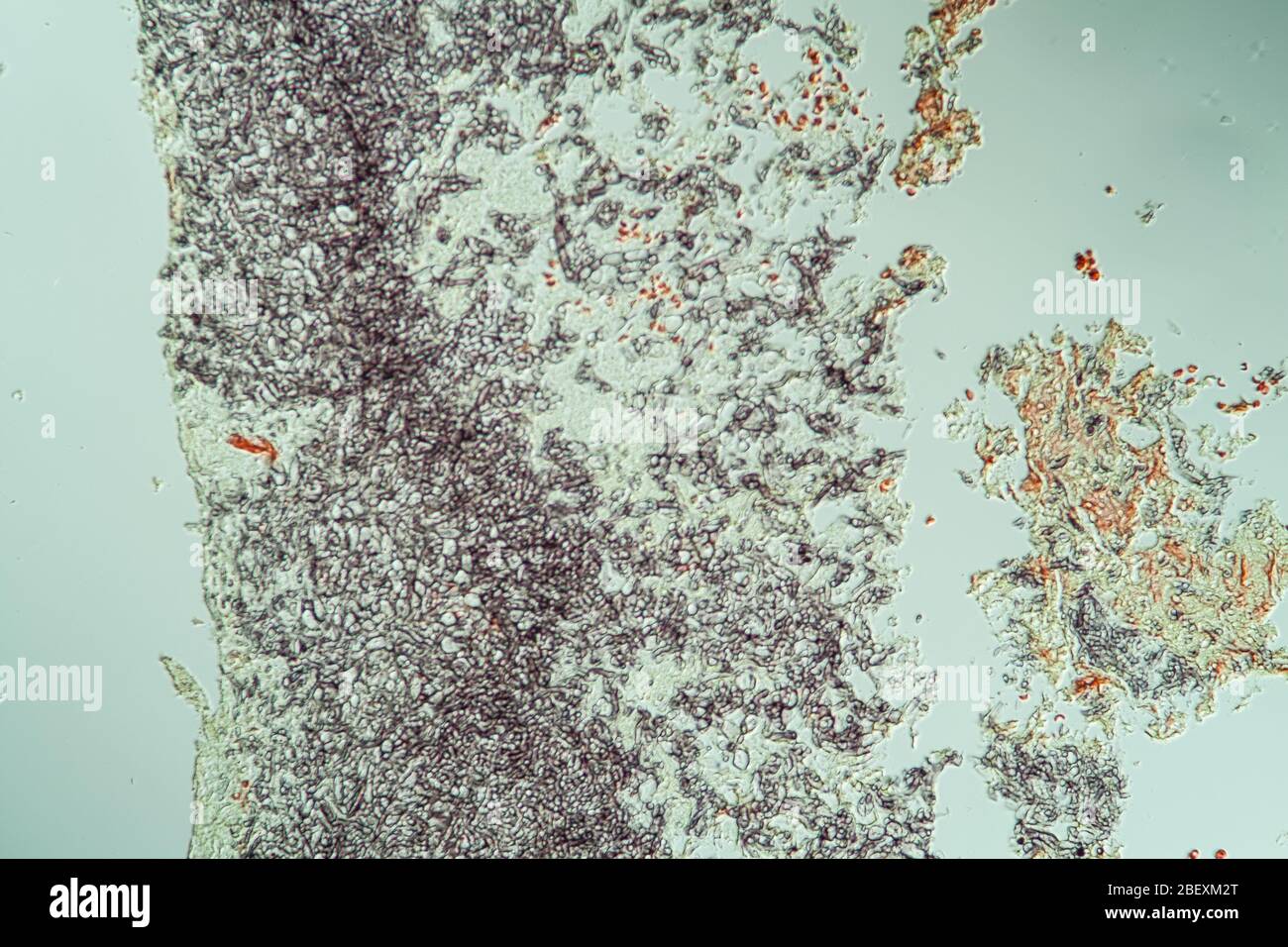 Aspergillus hi-res stock photography and images - Alamy