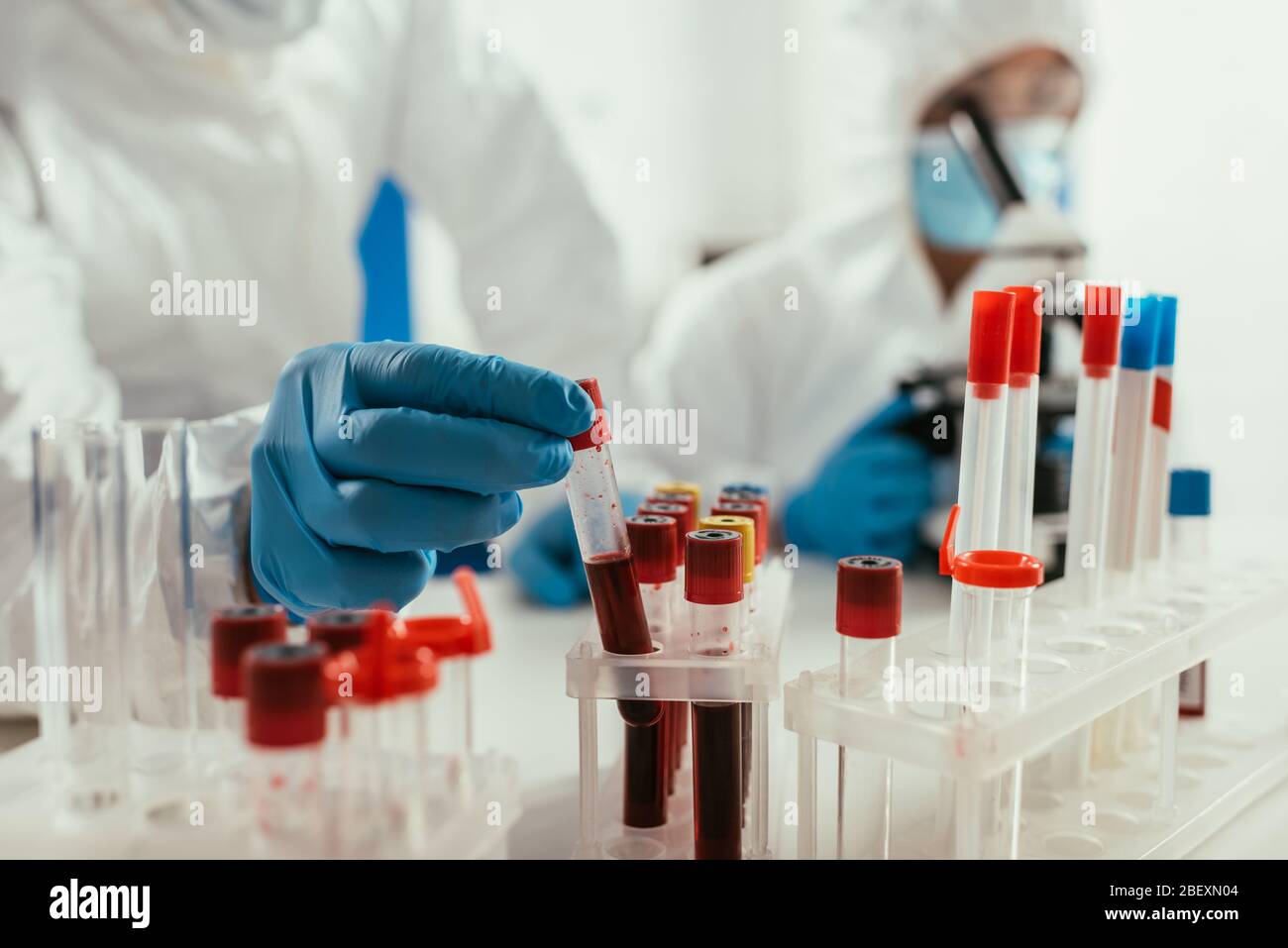 partial view of biochemist taking test tube with blood sample near ...