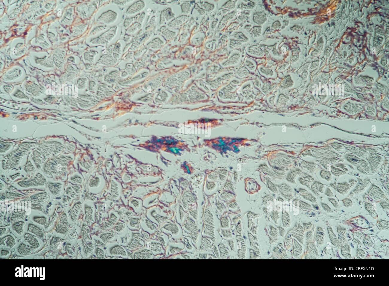 Heart tissue microscope hi-res stock photography and images - Alamy