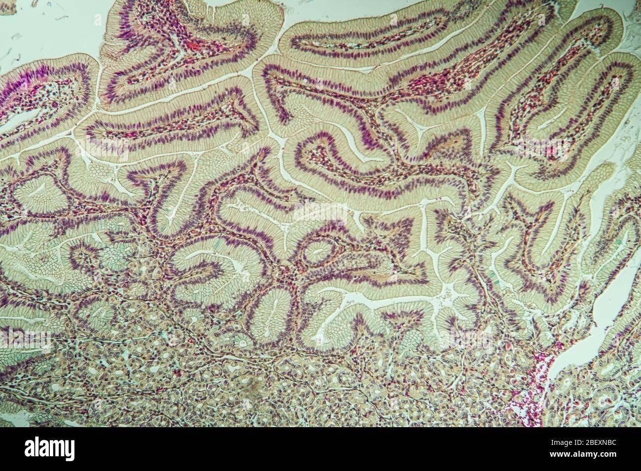 Large intestine with diverticular tissue under the microscope 100x ...