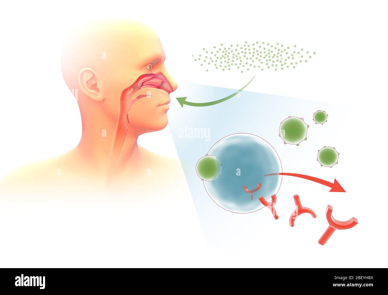 3d illustration depicting the mechanism of allergy in the respiratory ...