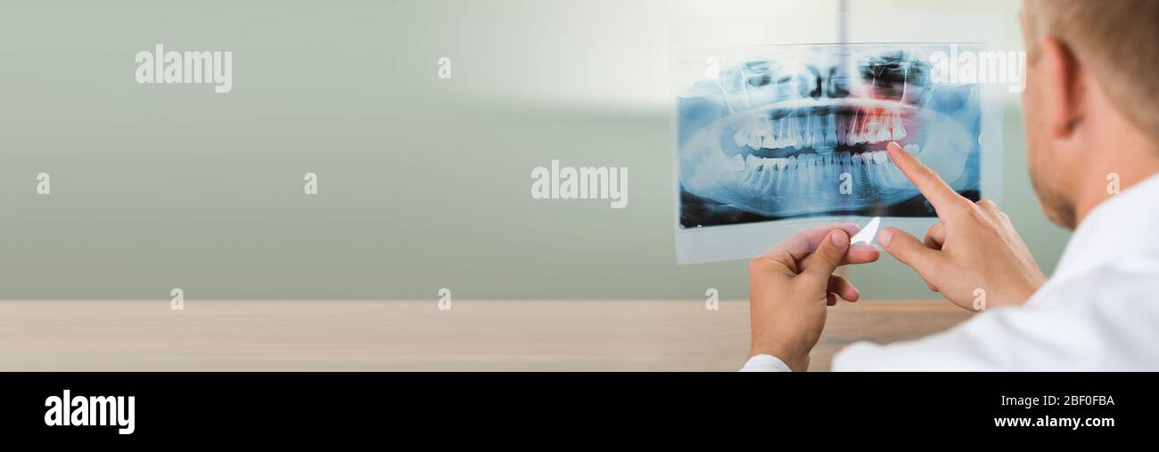 Dentist Doctor Looking At Jaw Tooth Dental Xray Stock Photo - Alamy