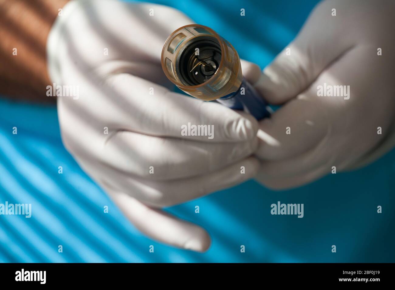 Periodontal scaler hi-res stock photography and images - Alamy