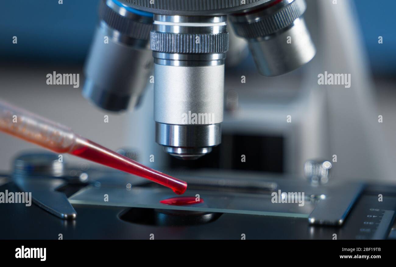 Hiv aids microscope hi-res stock photography and images - Alamy