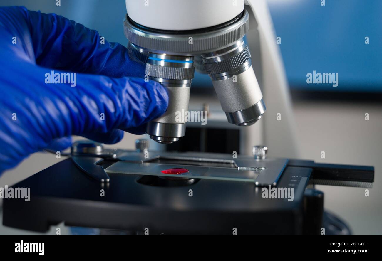 Hiv aids microscope hi-res stock photography and images - Alamy