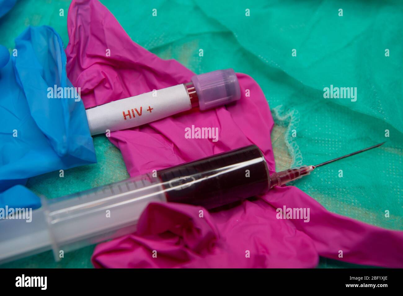 Blood sample hiv test hi-res stock photography and images - Alamy