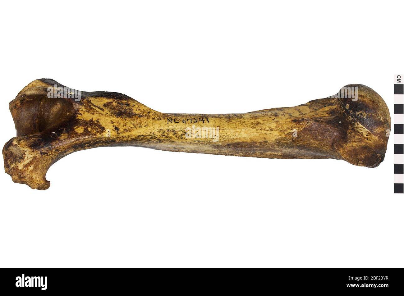 Left humerus hi-res stock photography and images - Alamy