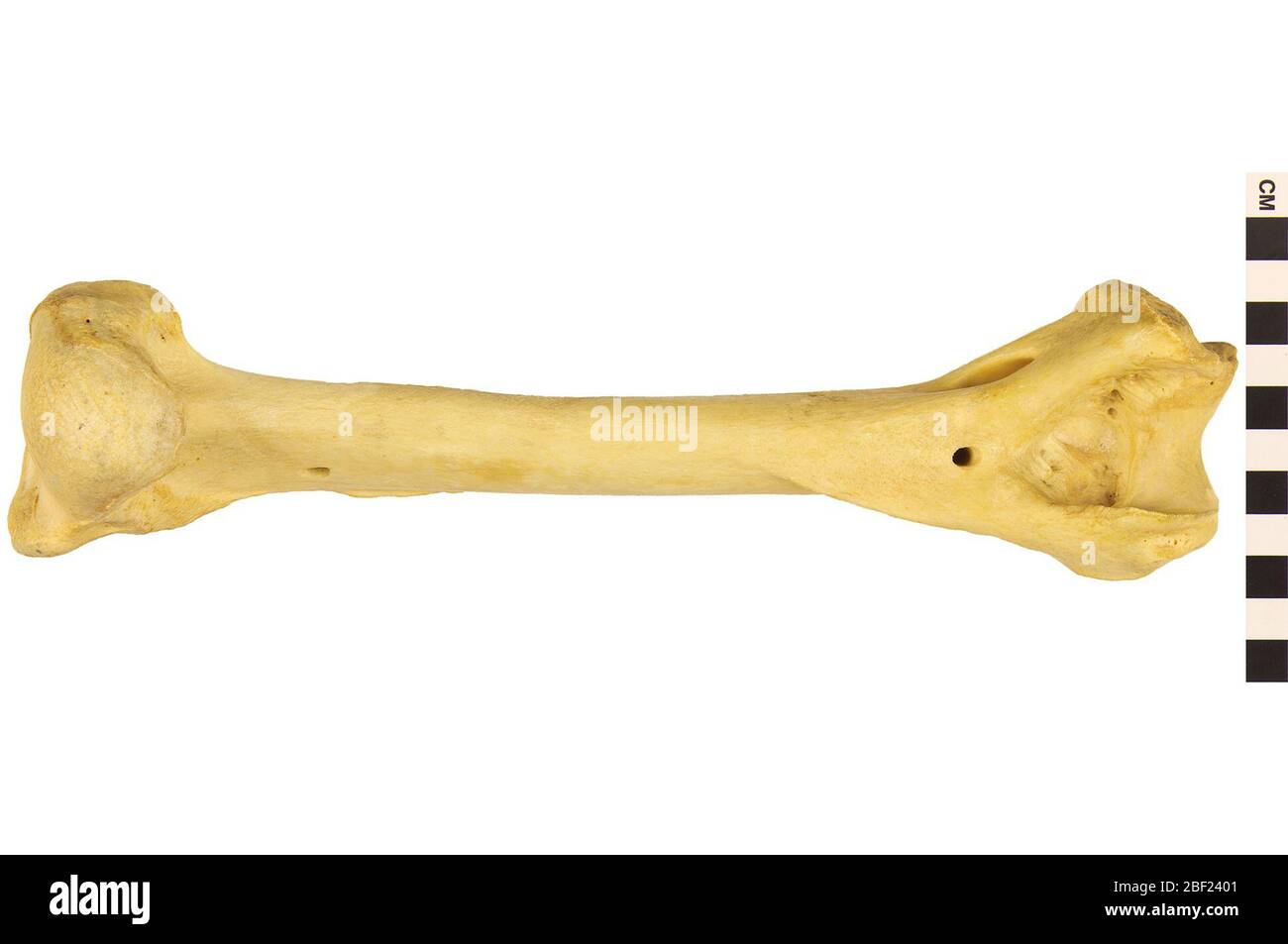 Left humerus hi-res stock photography and images - Alamy