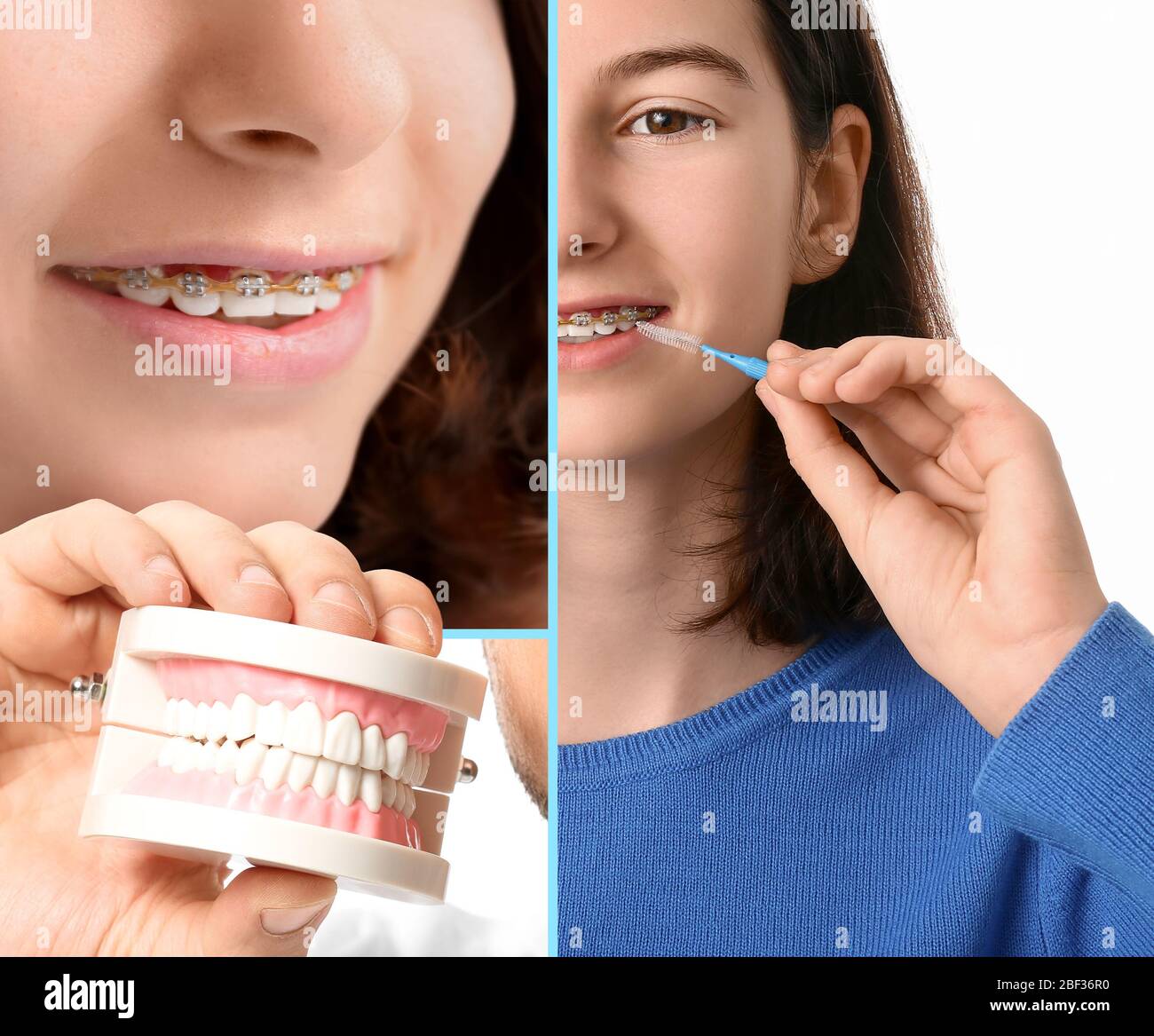 Overbite smile smiling hi-res stock photography and images - Alamy