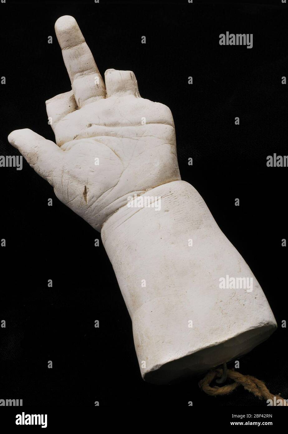 Cast of an Unidentified Babys Left Hand and Forearm first and little ...