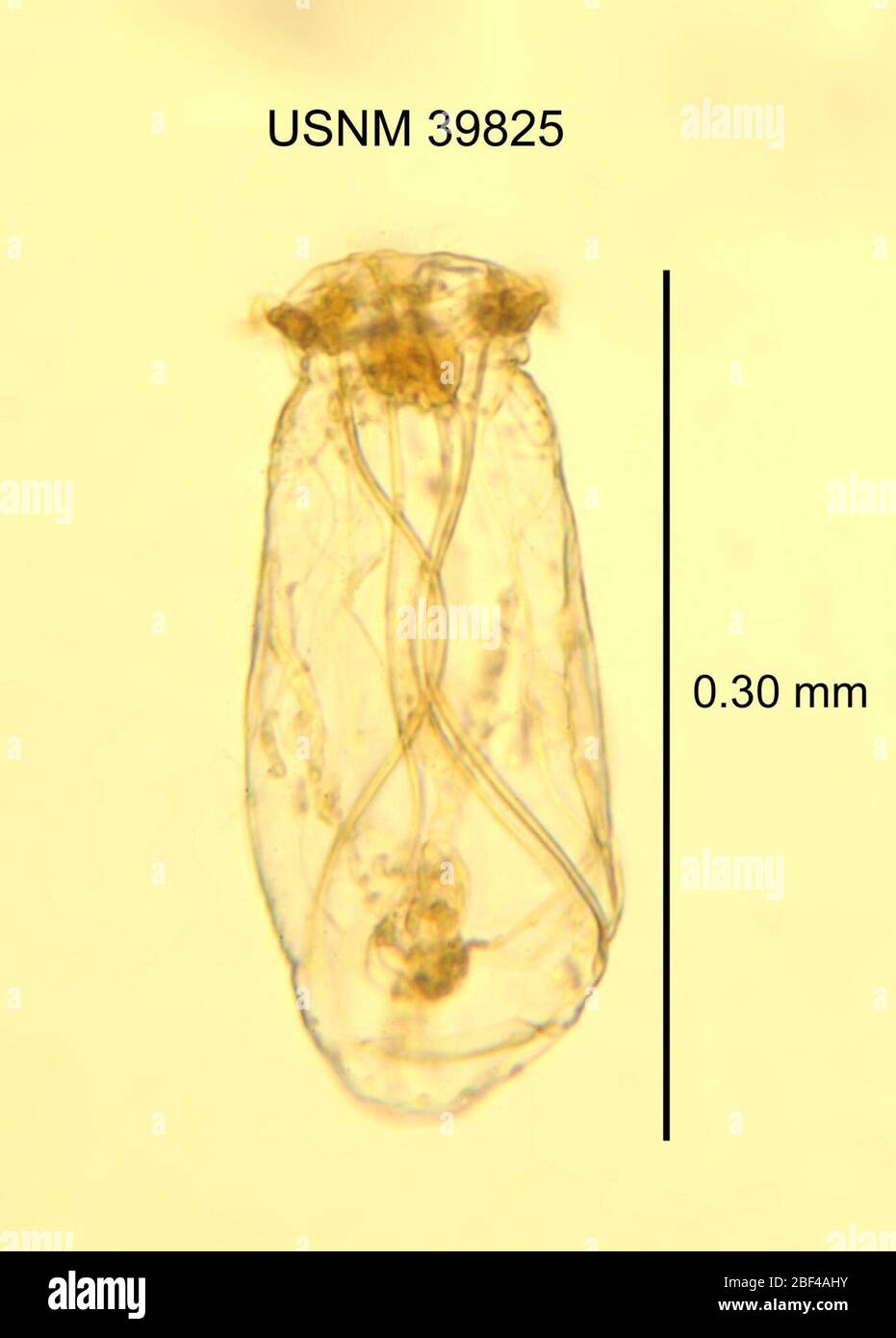Asplanchna priodonta. 10 Jan 20131 Stock Photo - Alamy