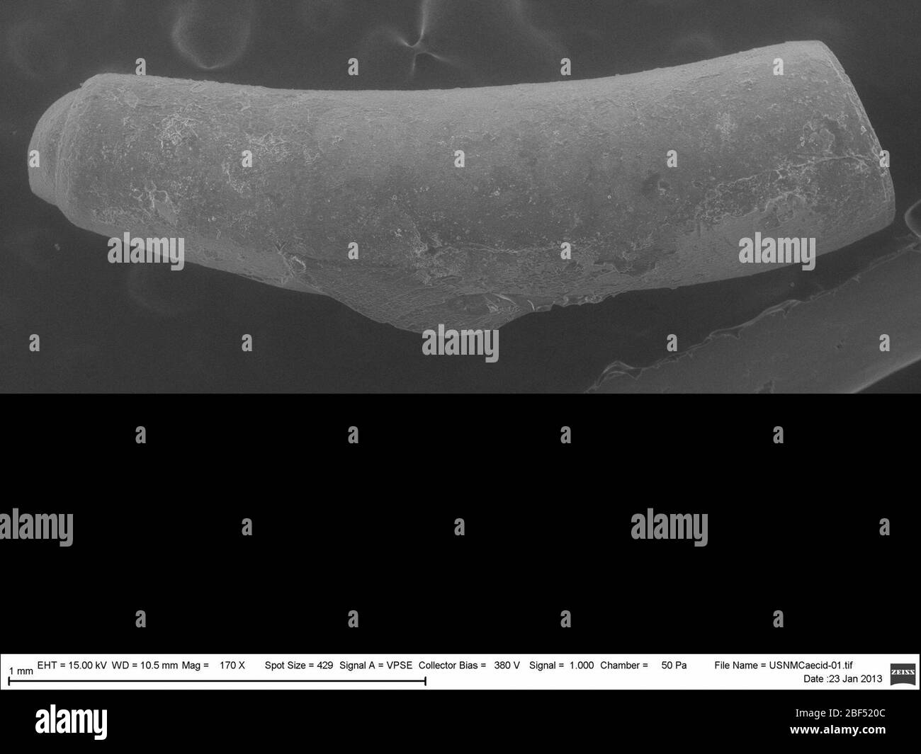 Caecum hi-res stock photography and images - Alamy