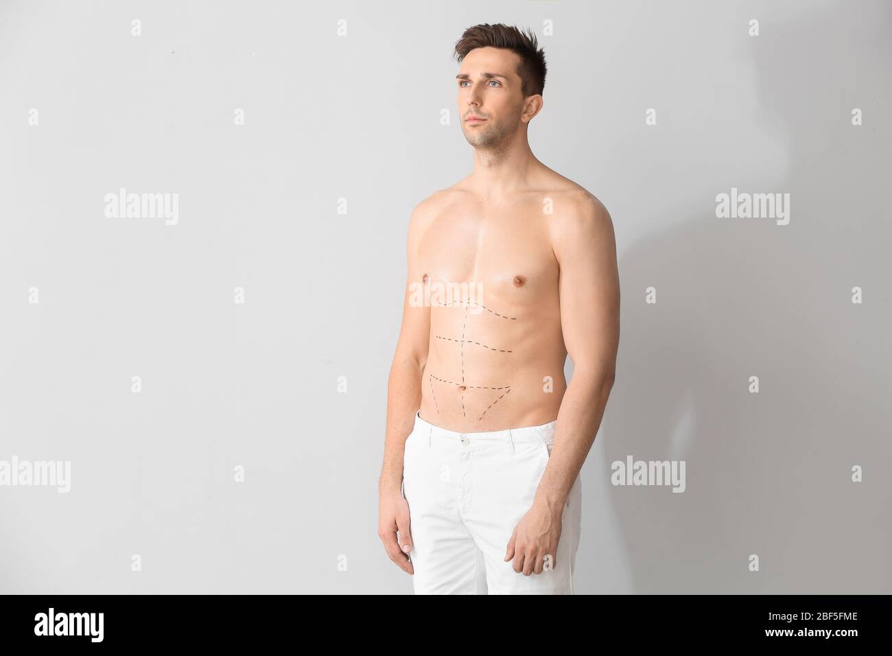 Young man with marks on his body against light background. Concept of ...