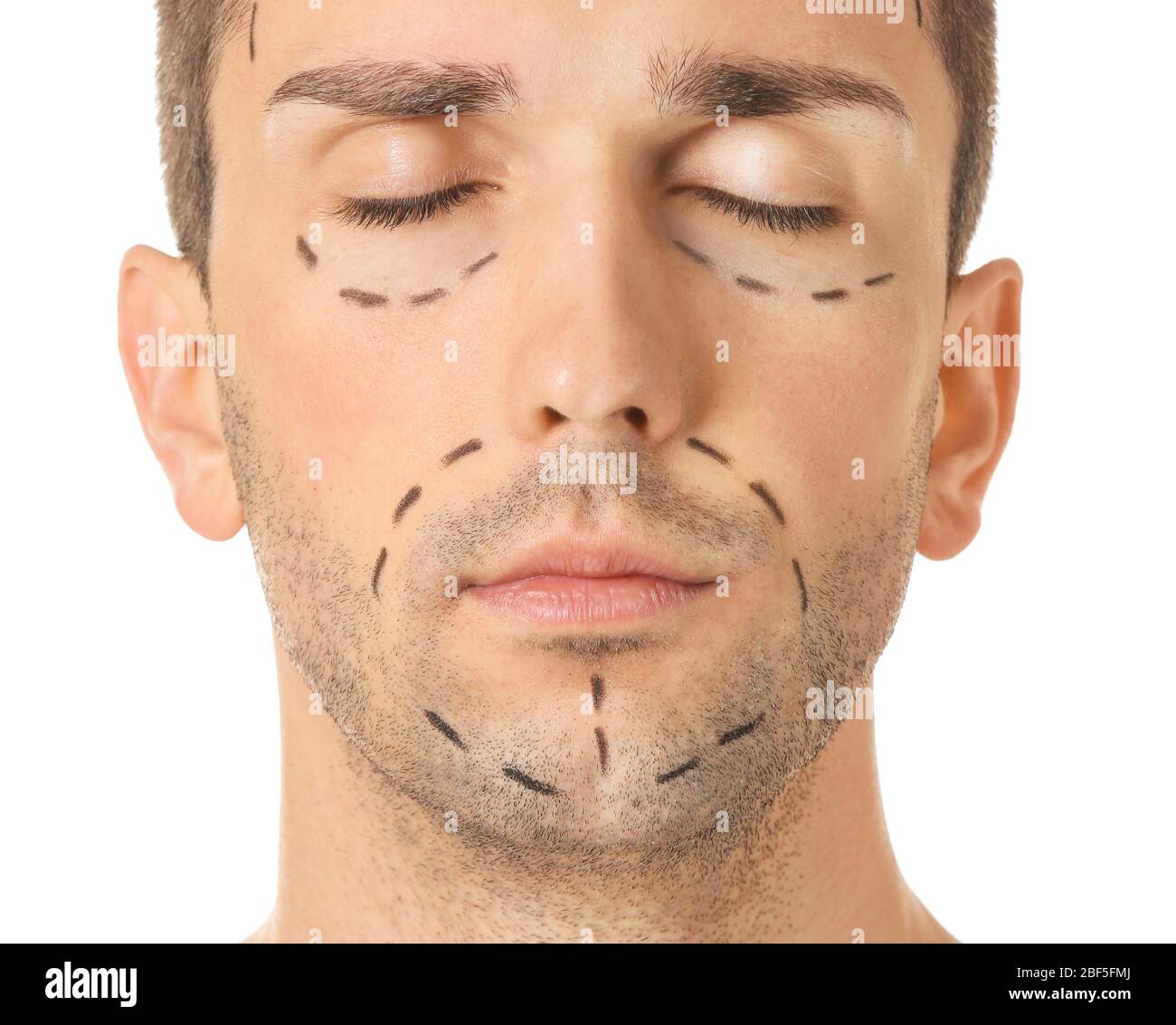 Young man with marks on his face against white background, closeup ...