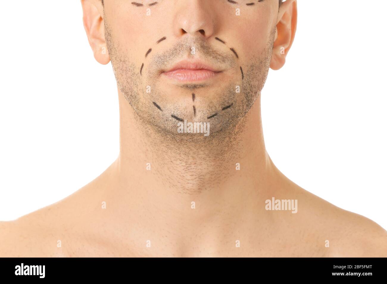 Young man with marks on his face against white background, closeup ...