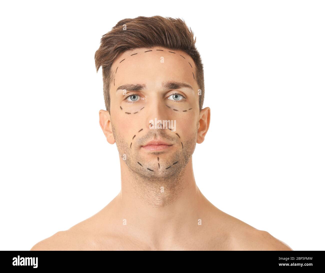 Man face surgery marks hi-res stock photography and images - Alamy