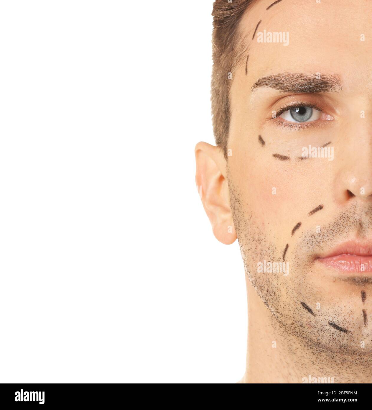 Man face surgery marks hi-res stock photography and images - Alamy