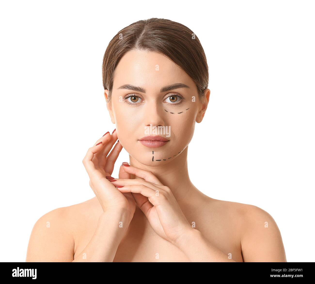 Young woman with marks on her face against white background. Concept of ...