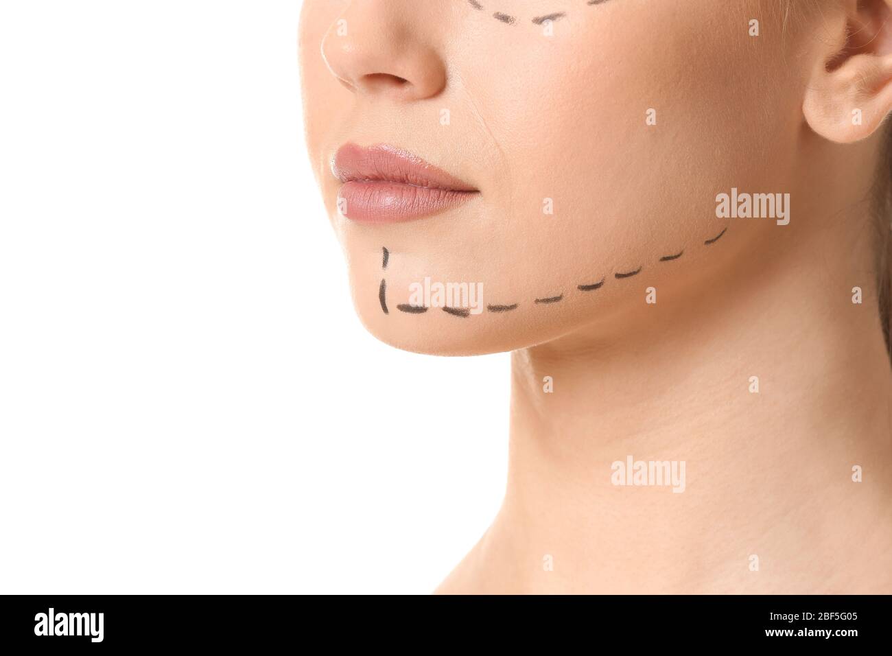 Young woman with marks on her face against white background, closeup ...