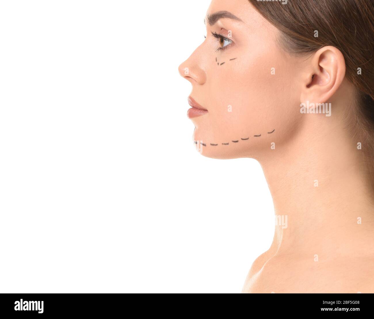 Young woman with marks on her face against white background. Concept of ...