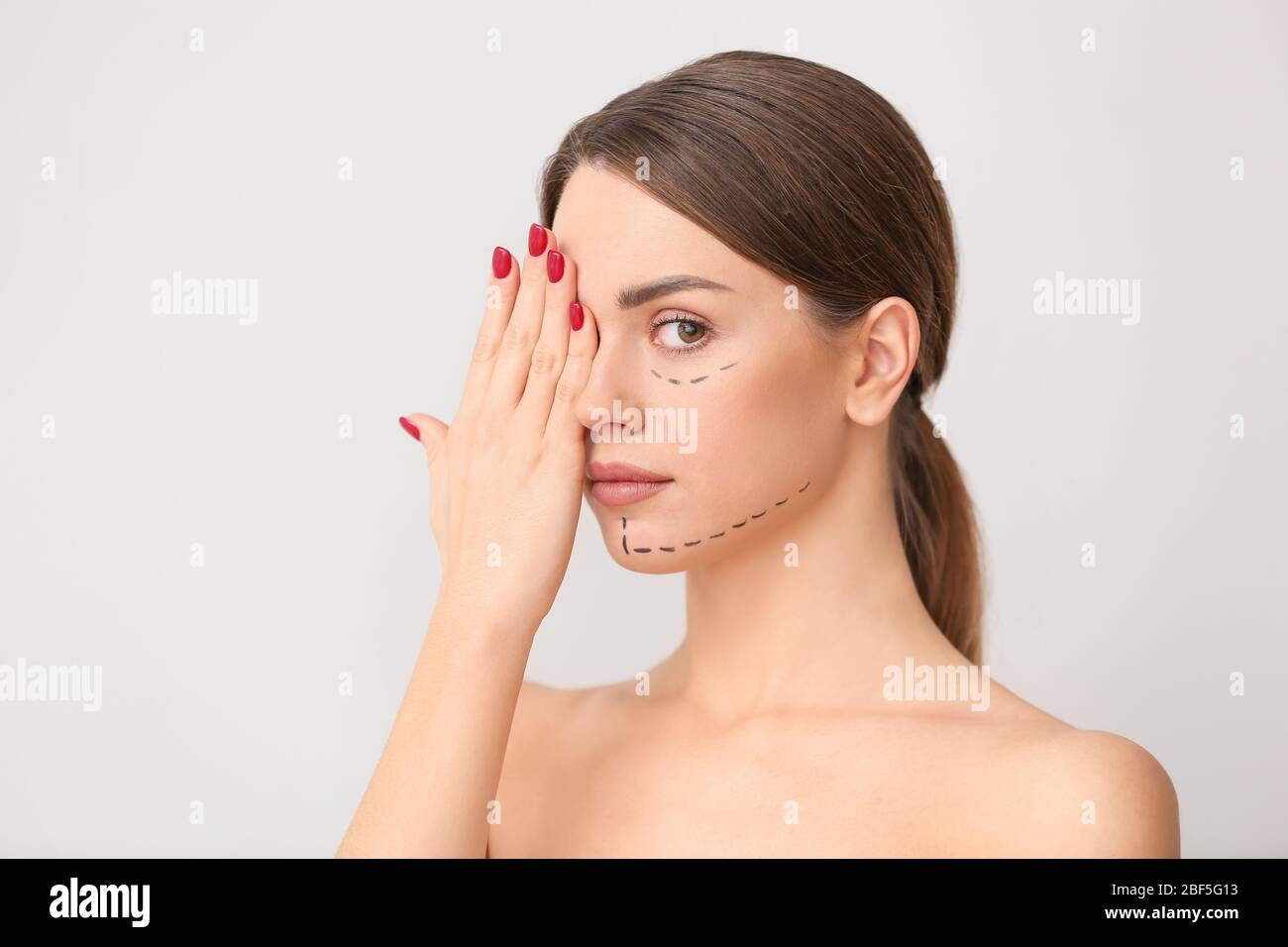 Young woman with marks on her face against light background. Concept of ...