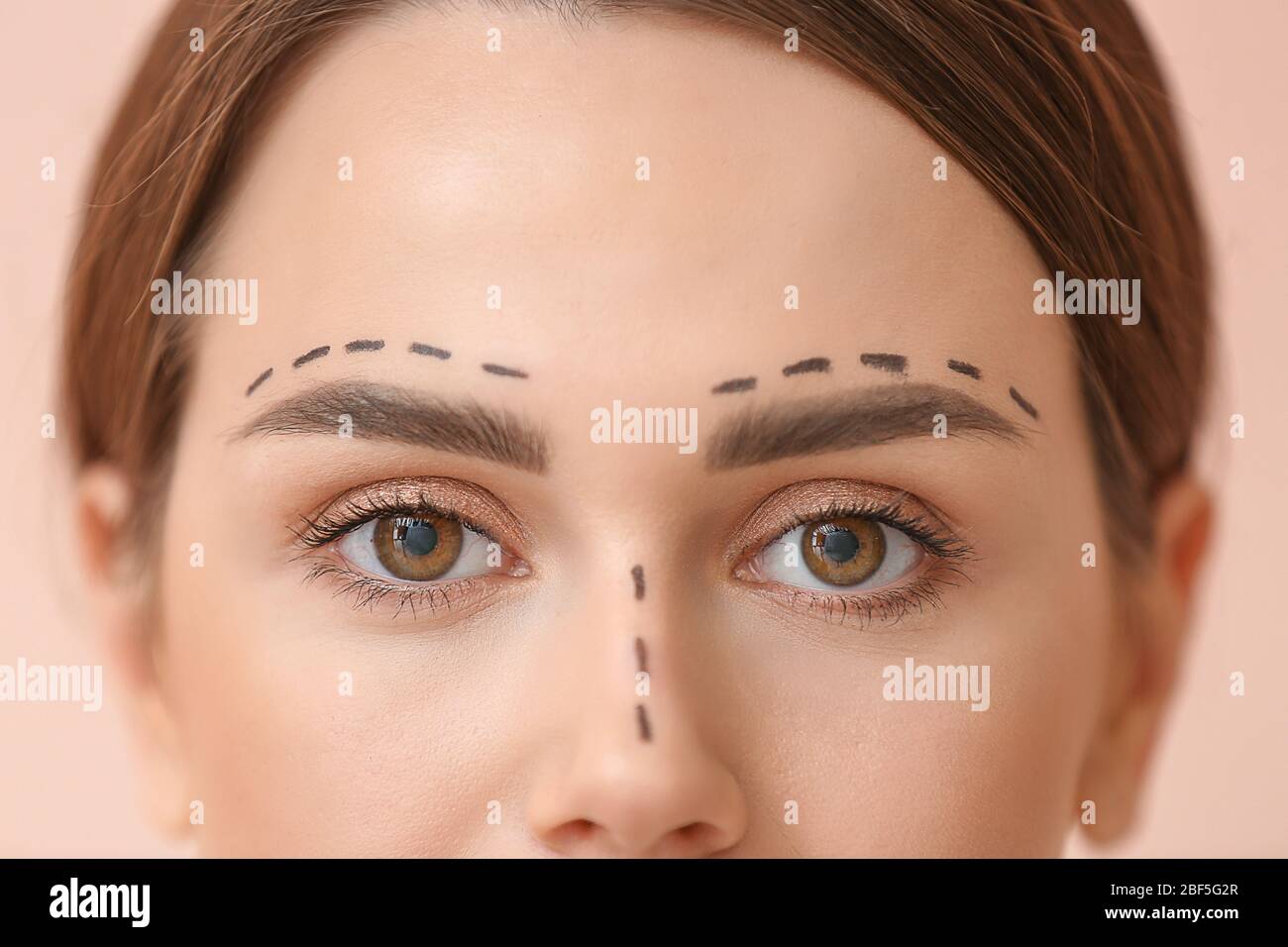 Young woman with marks on her face against color background, closeup ...