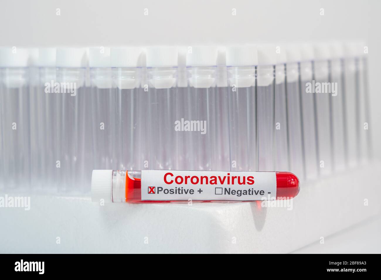 Coronavirus infection blood test sample in vacuum venipuncture tube ...