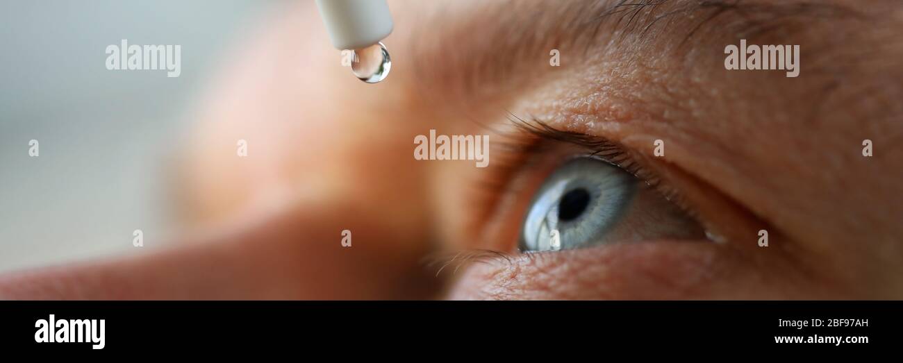 Man drops eye drops install lenses, moisturizing Stock Photo - Alamy