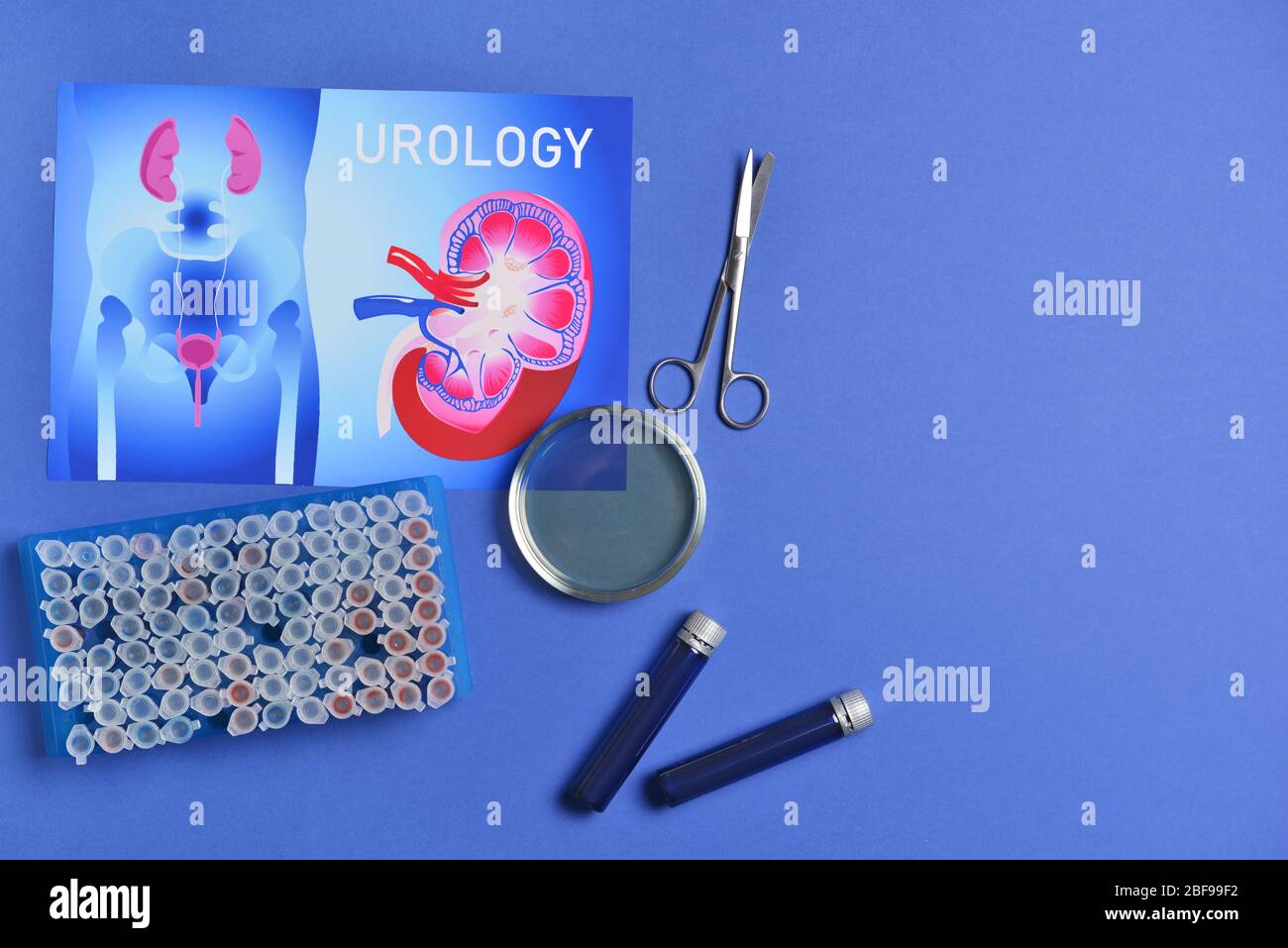 Picture of urogenital system, surgical scissors, blood and urine ...