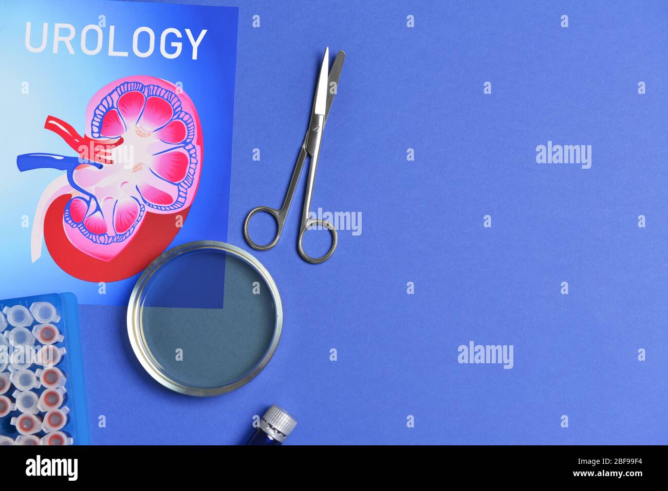 Picture of human kidney, surgical scissors, blood and urine samples on ...