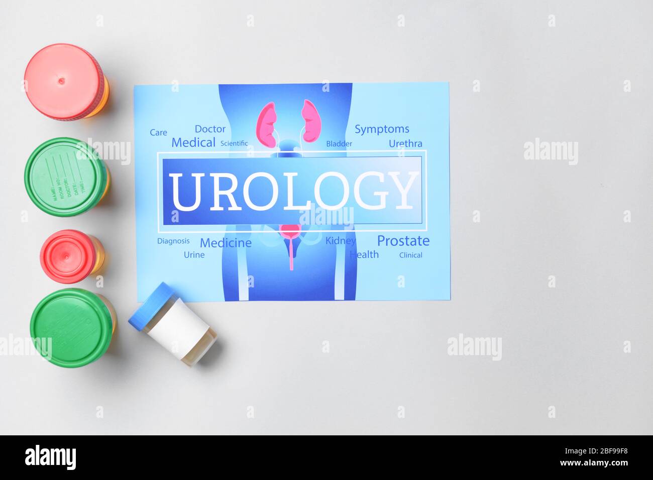 Picture of urogenital system and urine samples on white background ...