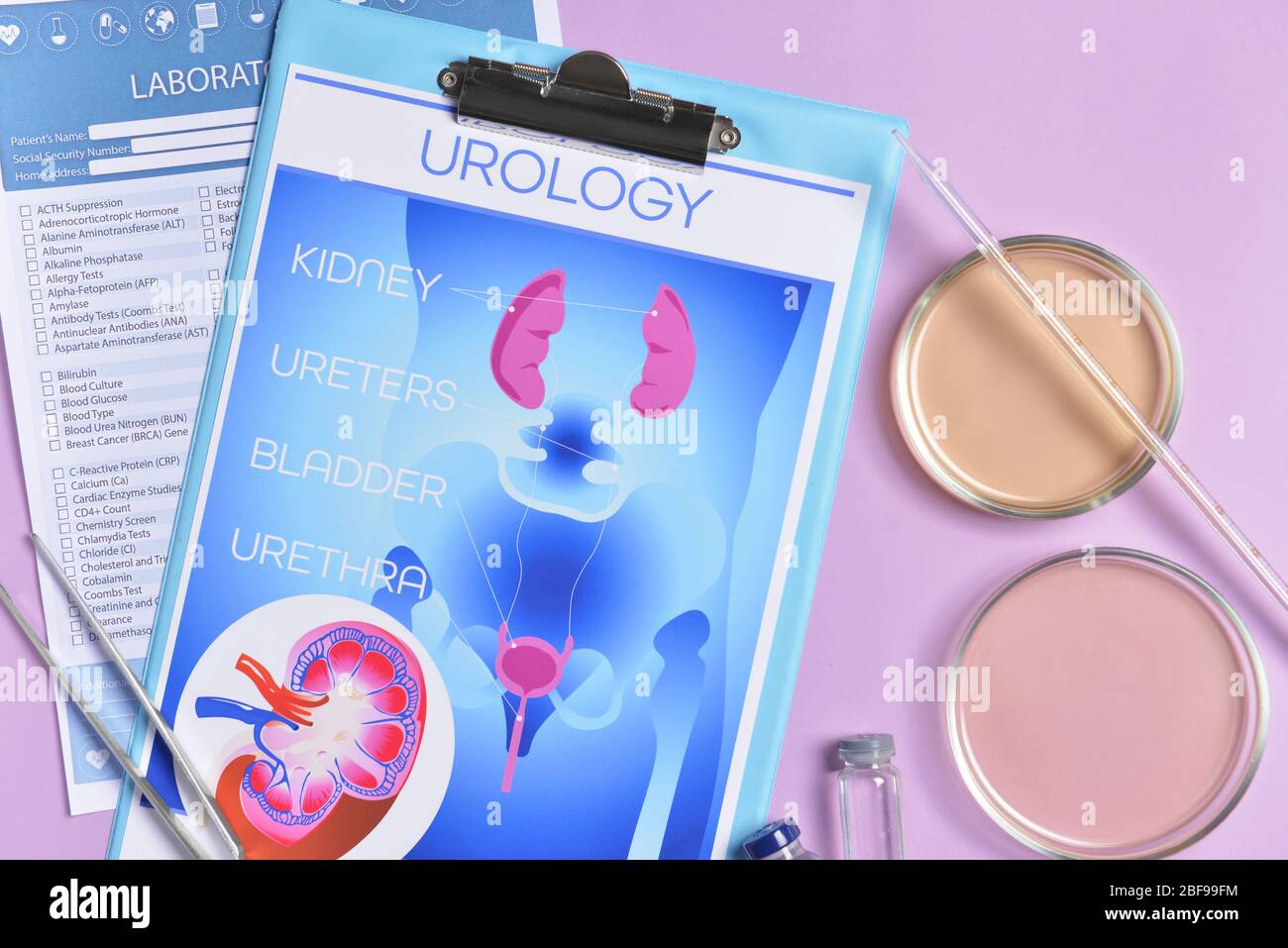 Picture of urogenital system, urine sample and laboratory test form on ...