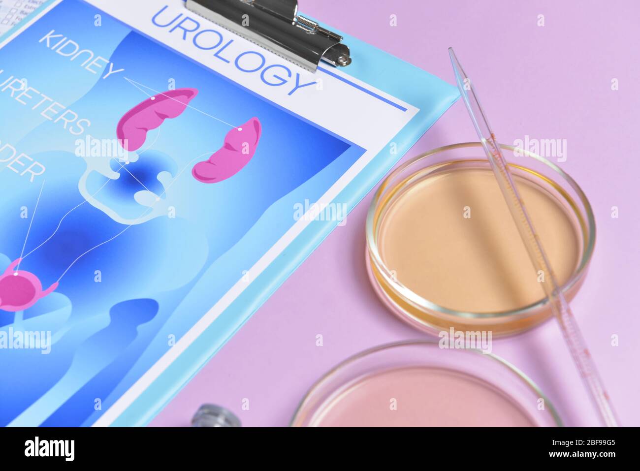 Picture of urogenital system and urine sample on color background Stock ...