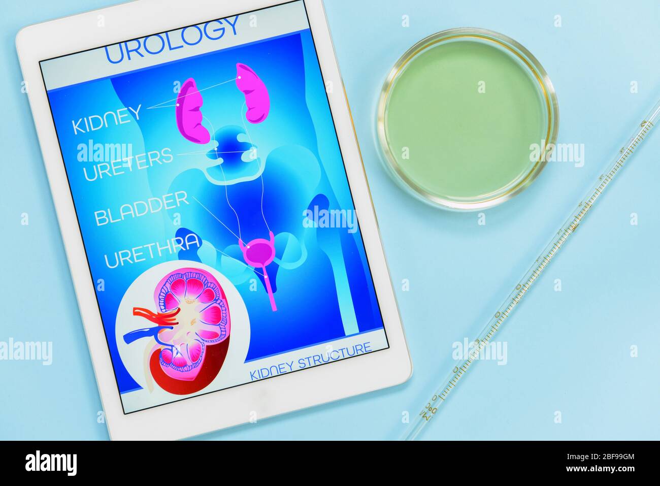 Tablet computer with picture of urogenital system on screen and urine ...