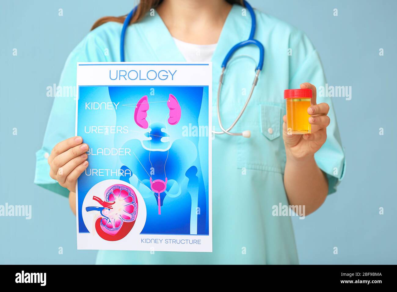 Doctor holding paper with picture of urogenital system and urine sample ...