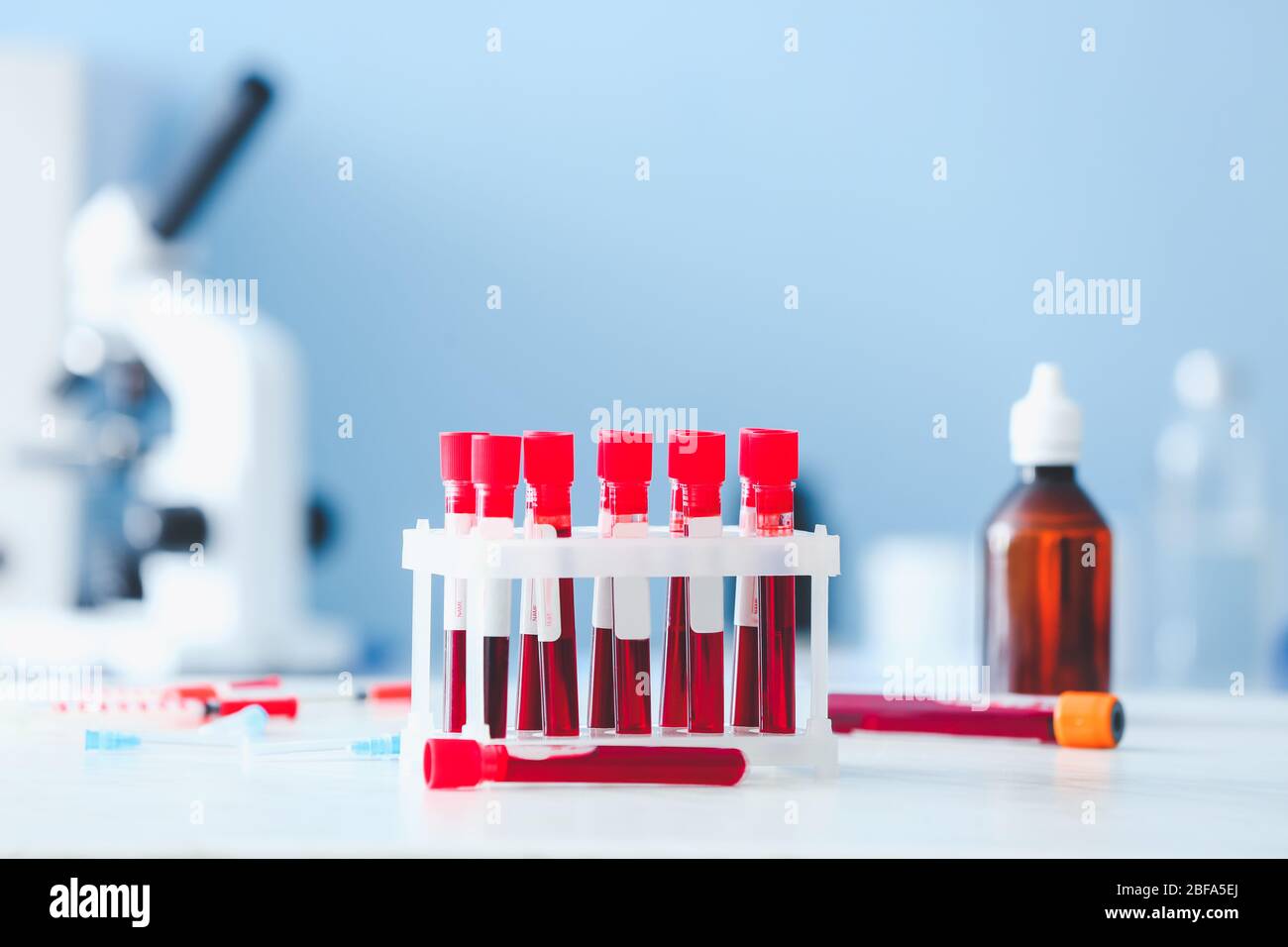 Test tubes with blood samples on table in laboratory Stock Photo - Alamy